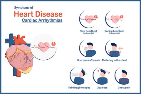 Heart Arrhythmia: A Comprehensive Guide - Longmore Clinic